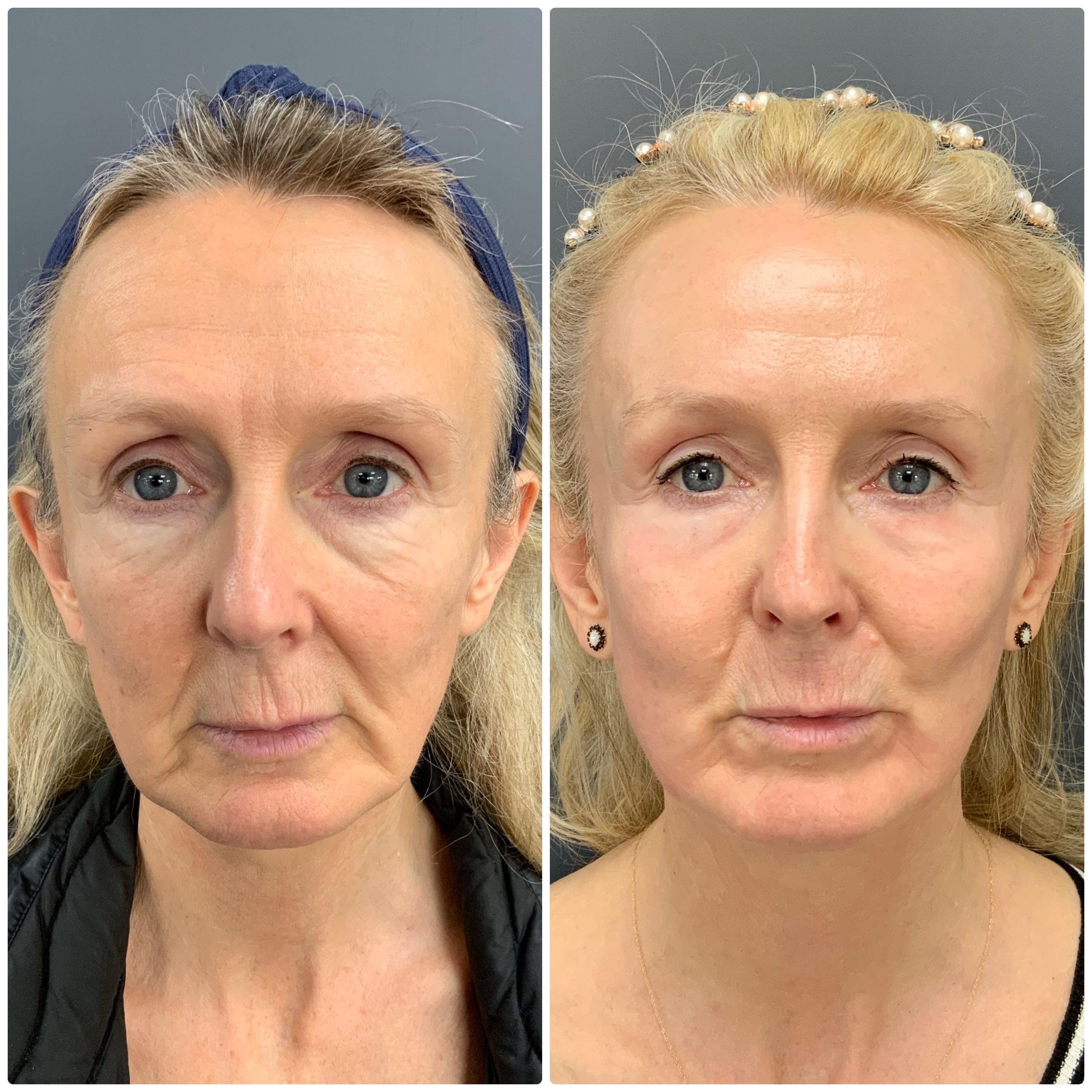 Yorkshire Skin Centre - Best Aesthetics Clinic in Leeds