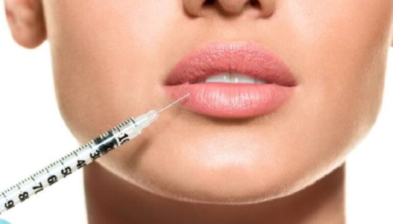 Lip Fillers Guide: Types, Benefits, Costs, and More | YSC