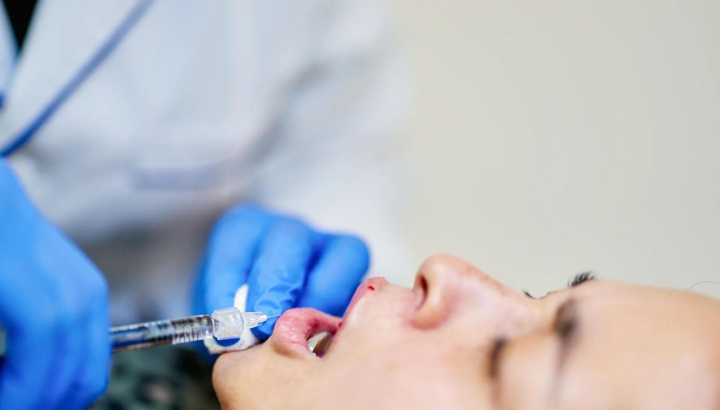 Lip Filler Healing Process Day by Day -Yorkshire Skin Centre