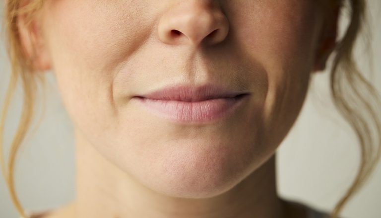 Nasolabial Folds: Everything You Need To Know