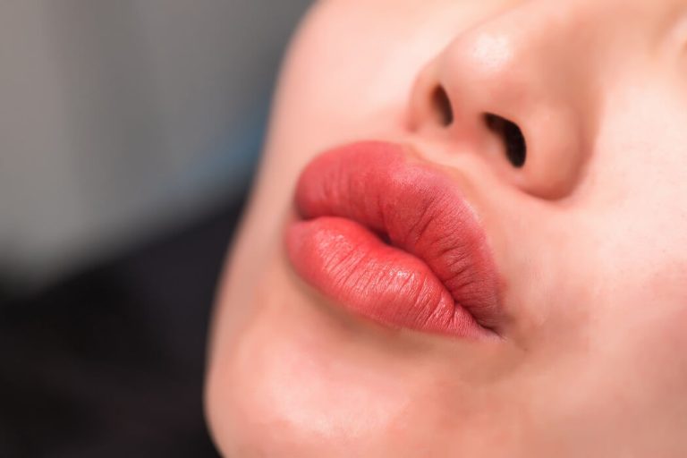 Lip Flip: What It Is, Procedure, Benefits & Side Effects
