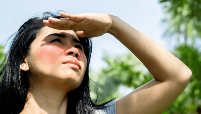 Sun Damaged Skin: Signs, Causes & Prevention Tips