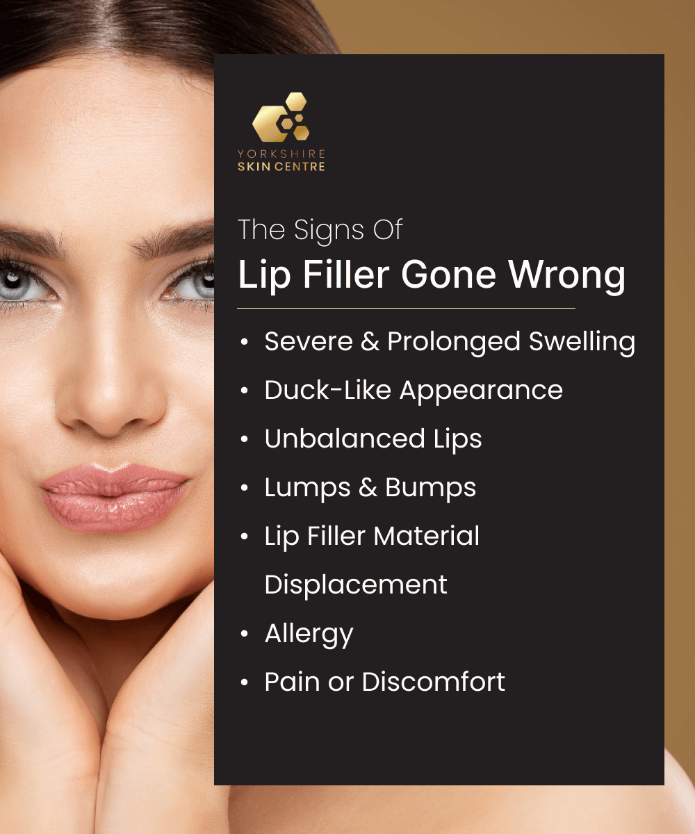 Lip Filler Gone Wrong: Signs, Solutions, and Prevention Tips