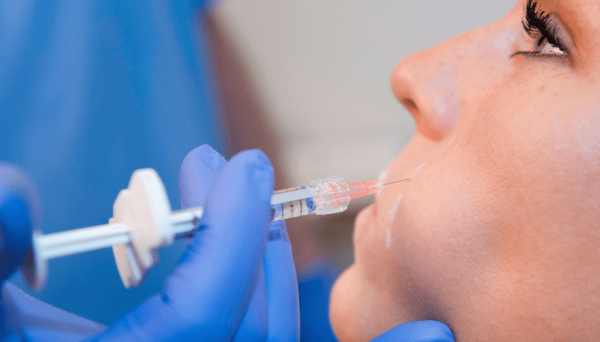 Lip Flip: What It Is, Procedure, Benefits & Side Effects