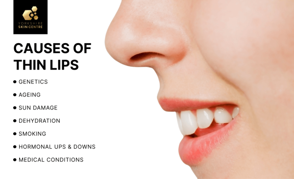 Thin Lips: Causes, Home Remedies and Treatments