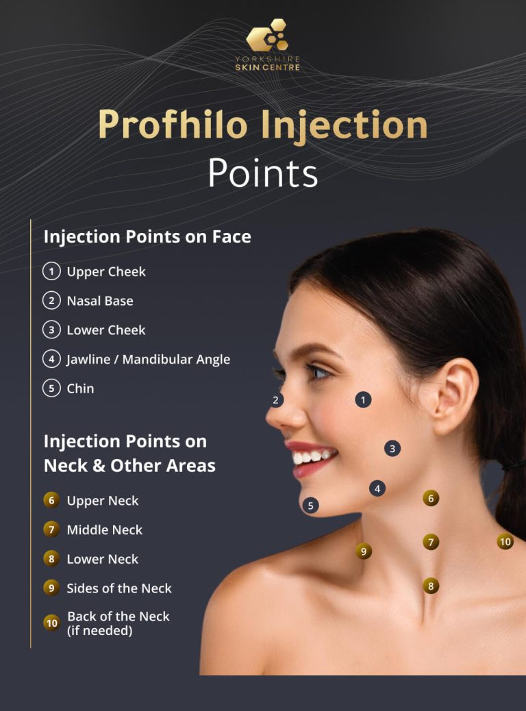 Profhilo Injection Points Explained | Face & Neck BAP Guide
