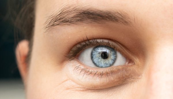 Uneven Eyebrows: Causes, Fixes, and Tips