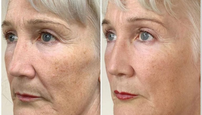 A Guide to Different Types of Breast Shapes - YSC